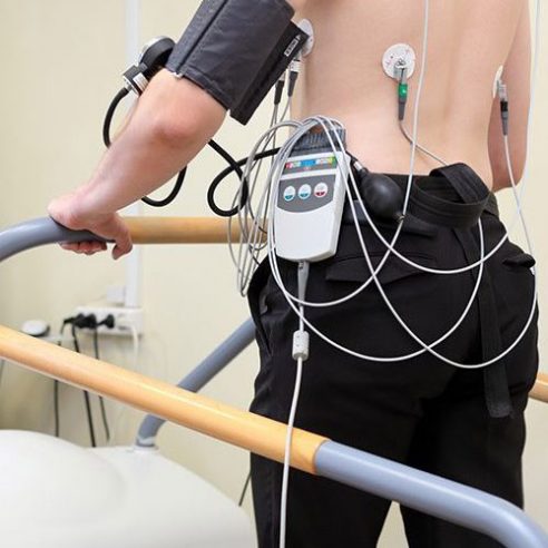 stress-test – Ιατροδιάγνωση